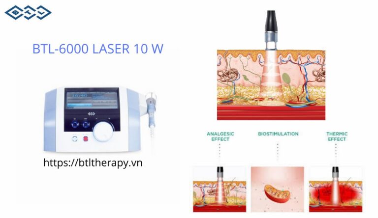 Máy Laser Công Suất Cao BTL 6000